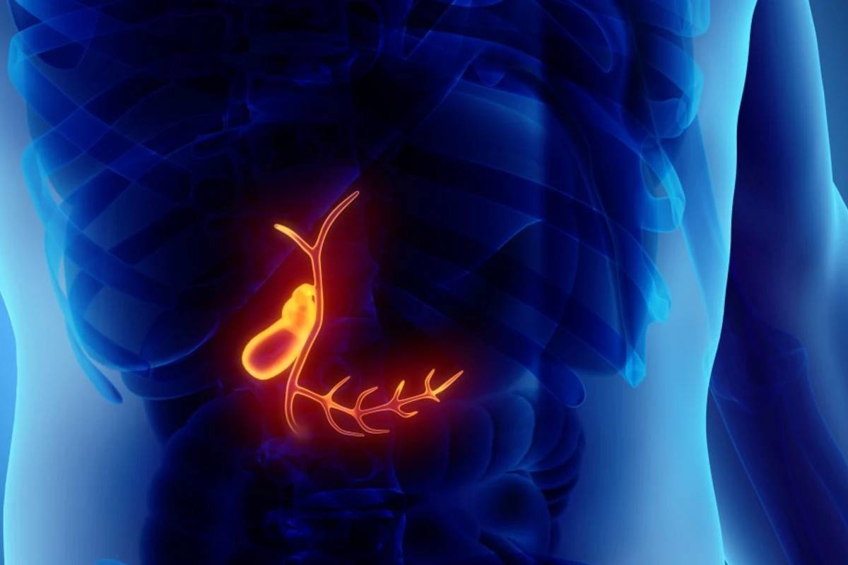 کیسه صفرا ؛ آشنایی با انواع بیماری و مشکلات آن - زومیت
